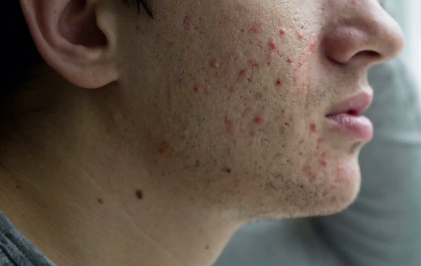 3 Warning signs your Colon is Toxic